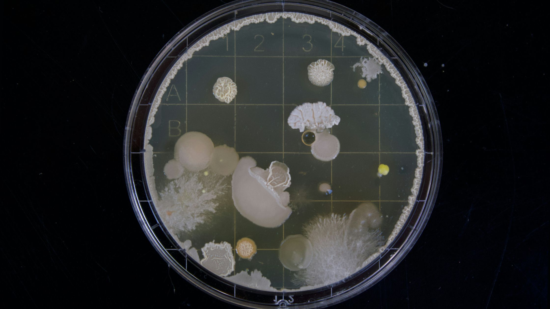 Using E. Coli As A Biosensor for Mercury Detection